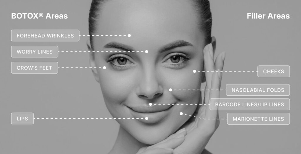 Botox in Cedar Park | B+A Medical Center